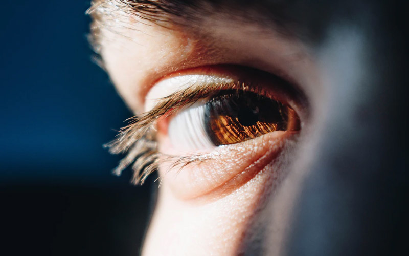 5 Recurrent Eye Problems You Should Not Dismiss – Biglaps.com