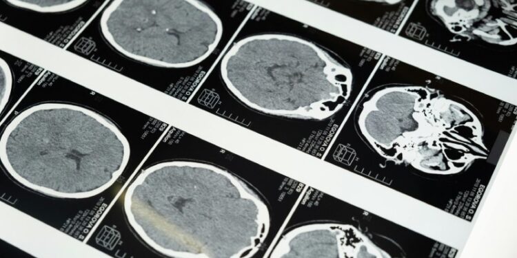 The 3 Most Prevalent Symptoms of a Brain Parasite Attack – Biglaps.com